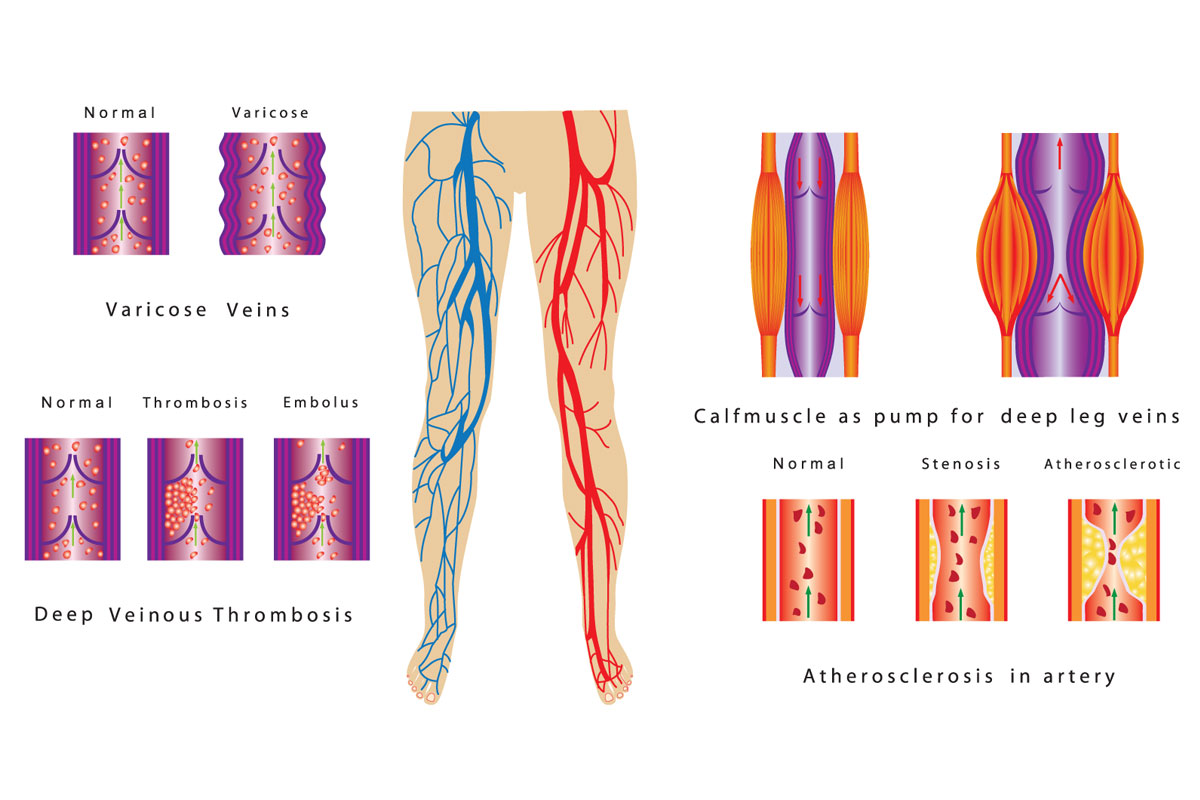 Vascular Care Houston | Vascular Diagnostics Magnolia